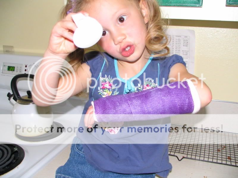 Broken Arm Pic | BabyCenter